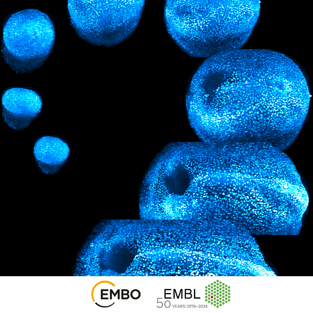 EMBO Workshop Imaging mouse development - FEBS