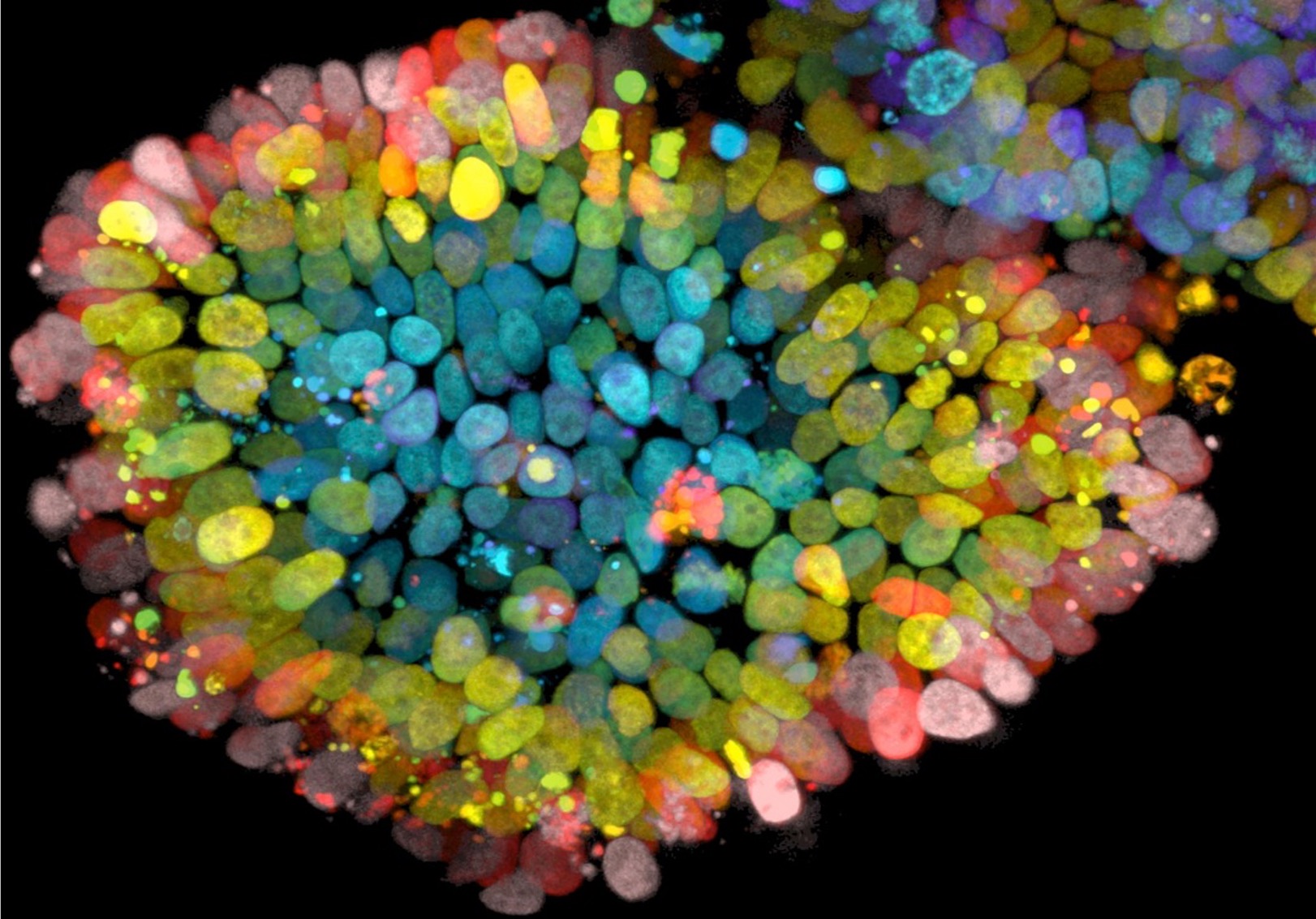 Cancer research; from fundamental insights to clinical application - FEBS